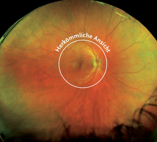 Netzhaut-Scan mit Optomap | Augenzentrum Mayer